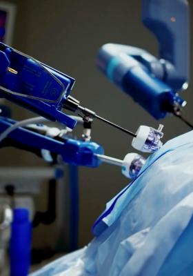 Asensus Surgical | Robotic Surgery Systems & Technology